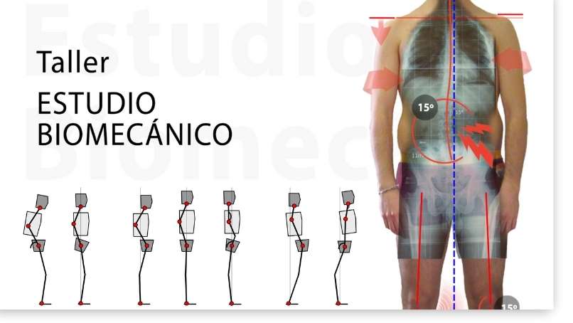 Checklist Rápido de Evaluación Postural – Fisiom